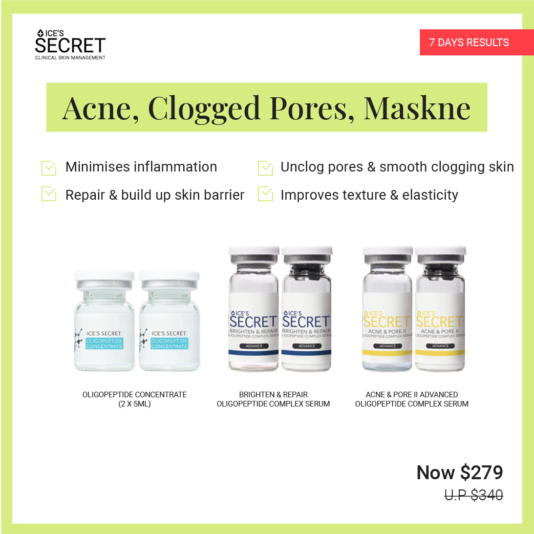 Acne, Clogged Pores, Mask Acne Serum Kit – Ice's Secret
